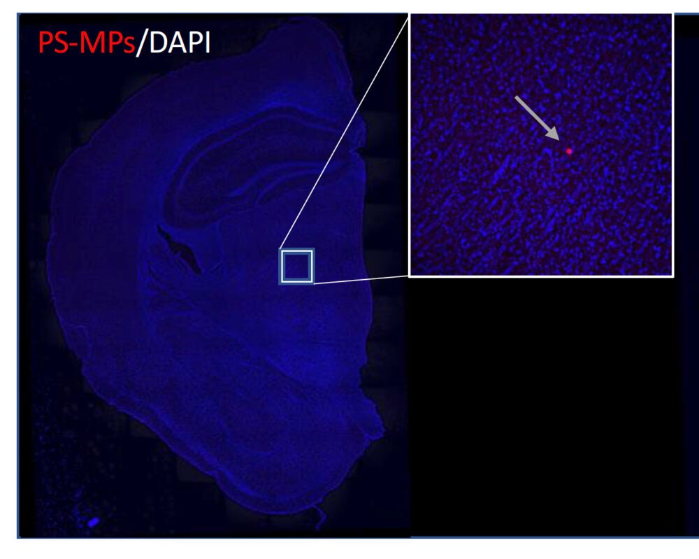 A new study investigates the impact of microplastics in the brain ...