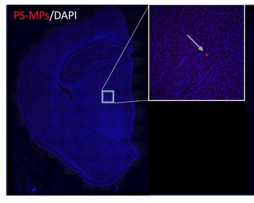 A new study investigates the impact of microplastics in the brain ...